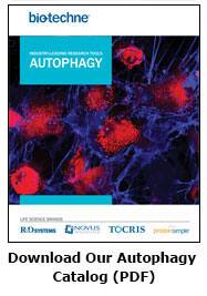 Autophagy: Novus Biologicals