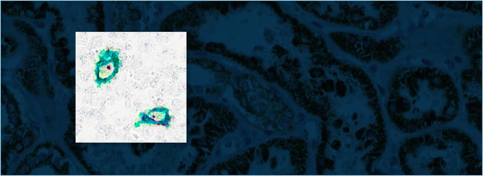 Antibodies, Kits, Proteins and Research Reagents: Novus Biologicals