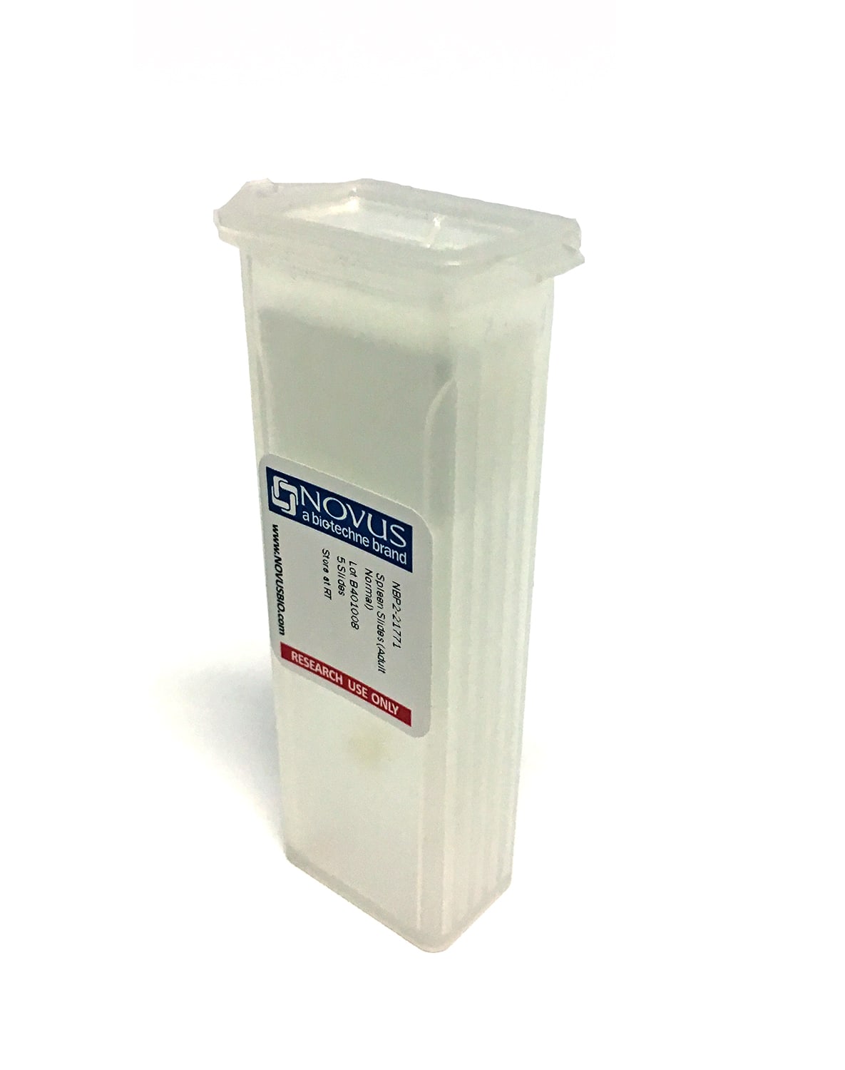 Squamous cell carcinoma tissue Slides (Diseased) (S160W0): Novus ...