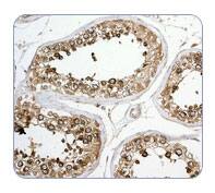 Plasma Membrane Markers: Novus Biologicals