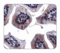 Mitochondrial Markers: Novus Biologicals