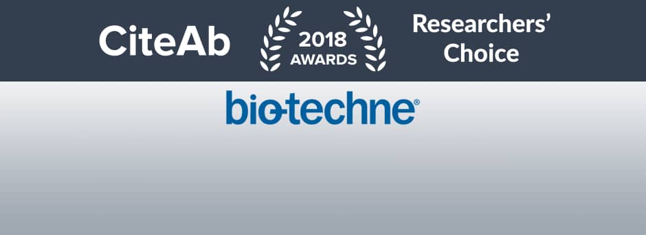 Antibodies, Kits, Proteins and Research Reagents: Novus Biologicals