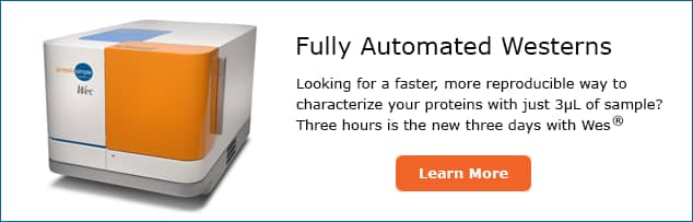 Western Blotting Products and Resources: Novus Biologicals