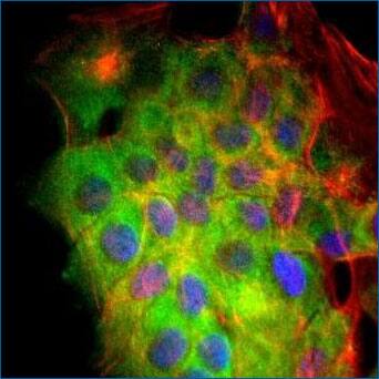 Exosome Marker Antibodies: Novus Biologicals