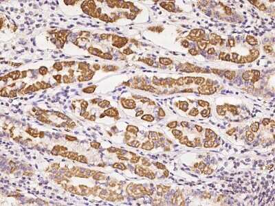 APOBEC3D Antibody (NBP2-97987): Novus Biologicals