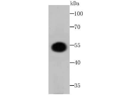 Avian avulavirus 1 Fusion Glycoprotein F0 Antibody (NBP2-80440): Novus ...