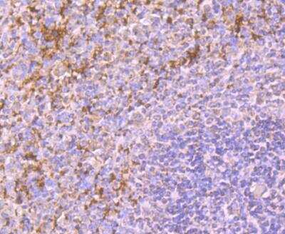 CD42b/GPIb alpha Antibody (NBP2-89128): Novus Biologicals