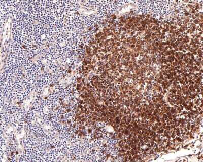 CD79A Antibody (JE43-50) (NBP2-80443): Novus Biologicals