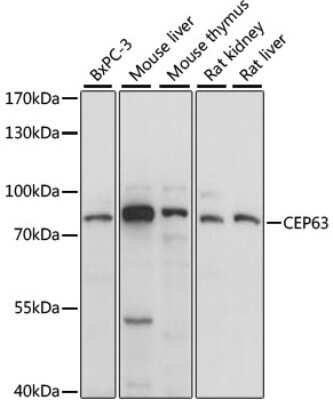 CEP63 Antibody - Azide and BSA Free (NBP2-92243): Novus Biologicals