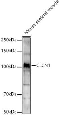 CLCN1 Antibody - BSA Free (NBP2-92461): Novus Biologicals