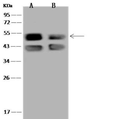 CRTAP Antibody (NBP3-06480): Novus Biologicals