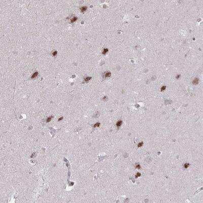 DAGLA Antibody - BSA Free (NBP2-31856): Novus Biologicals