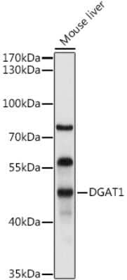 DGAT1 Antibody - BSA Free (NBP2-92984): Novus Biologicals