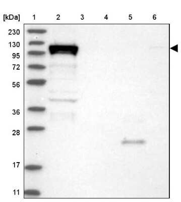 DHX36 Antibody - BSA Free (NBP1-84286): Novus Biologicals