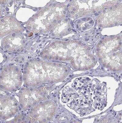 EN1/Engrailed 1 Antibody (NBP2-57757): Novus Biologicals