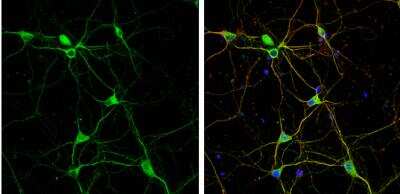 Granulin Antibodies: Novus Biologicals