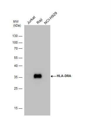 HLA DRA Antibody (NBP1-33458): Novus Biologicals