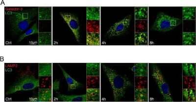 Anti-LC3B Antibodies: Novus Biologicals