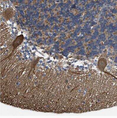 MMRN2 Antibodies: Novus Biologicals