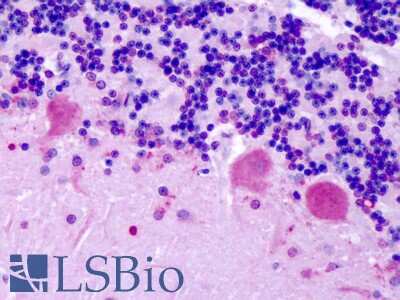 Muscarinic Acetylcholine Receptor M2/CHRM2 Antibody (NLS1831): Novus ...