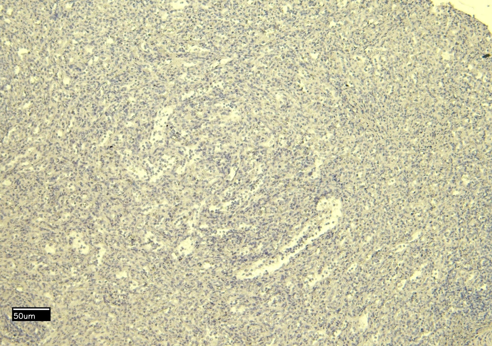 AIF-1/Iba1 Antibody (NB100-1028): Novus Biologicals