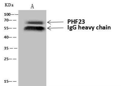 PHF23 Antibody (NBP3-14646): Novus Biologicals