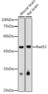 RAD52 Antibody - BSA Free (NBP2-95195): Novus Biologicals