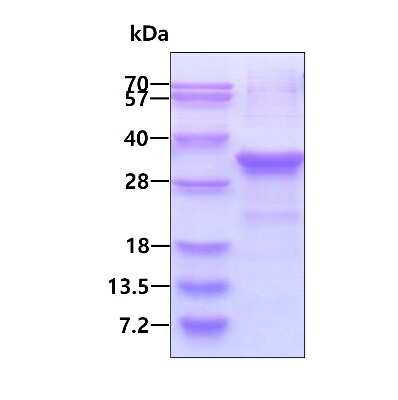 Recombinant Human DENR His Protein (NBP1-72446): Novus Biologicals