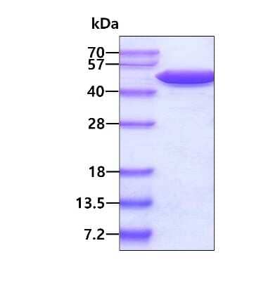 Recombinant Human Enolase 1 Protein (NBP1-30262): Novus Biologicals