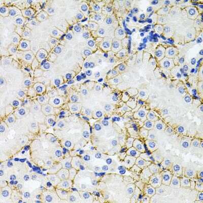 SLC1A4 Antibody - Azide and BSA Free (NBP2-95196): Novus Biologicals