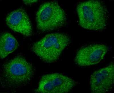 Smad2 Antibody (C9-B0) (NBP2-80403): Novus Biologicals