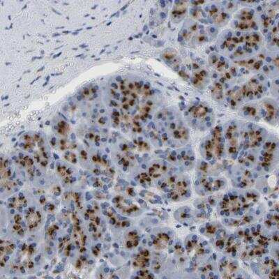 TMEM87A Antibody - BSA Free (NBP1-90532): Novus Biologicals