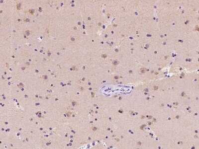 TSPAN3 Antibody (NBP2-98555): Novus Biologicals