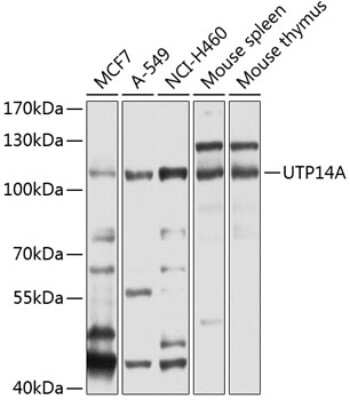 UTP14A Antibody - BSA Free (NBP2-93627): Novus Biologicals