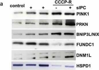 PINK1 Antibody - BSA Free (BC100-494): Novus Biologicals