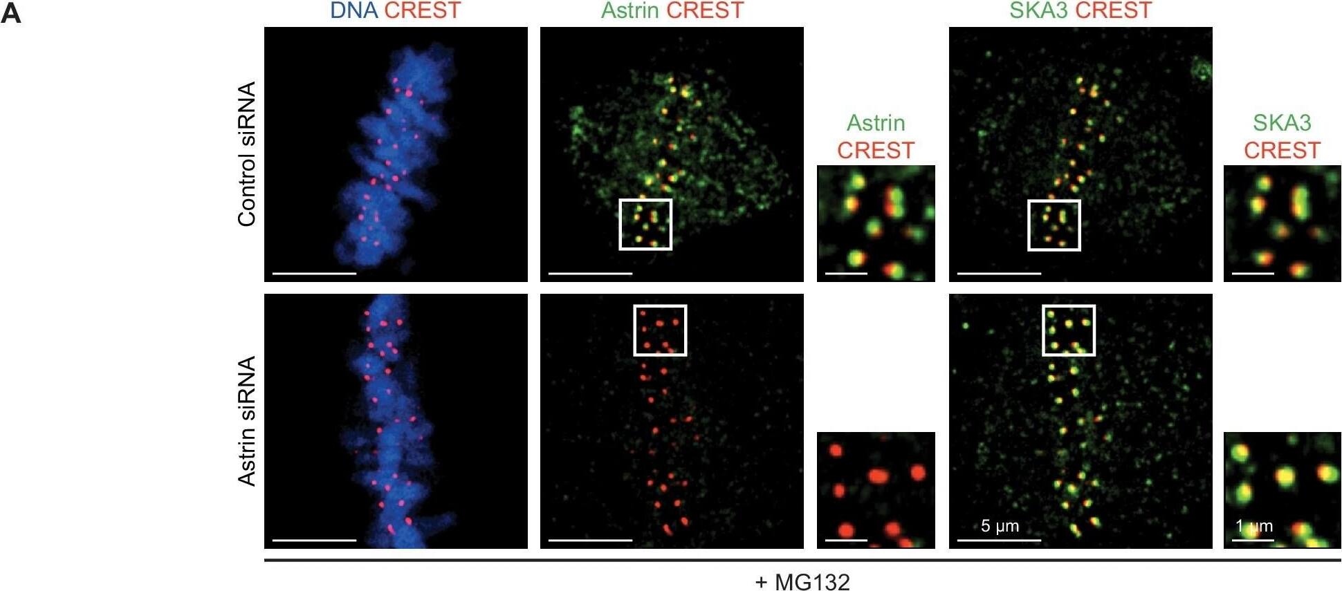 Astrin Antibody (NB100-74638): Novus Biologicals