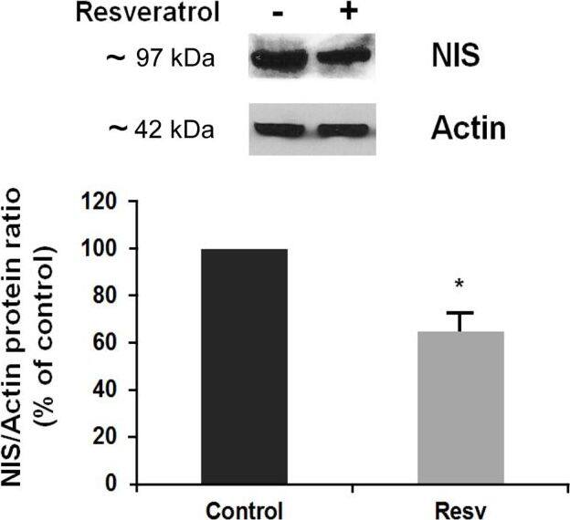 SLC5A5/Sodium Iodide Symporter Antibody (FP5) (NBP1-70342): Novus ...