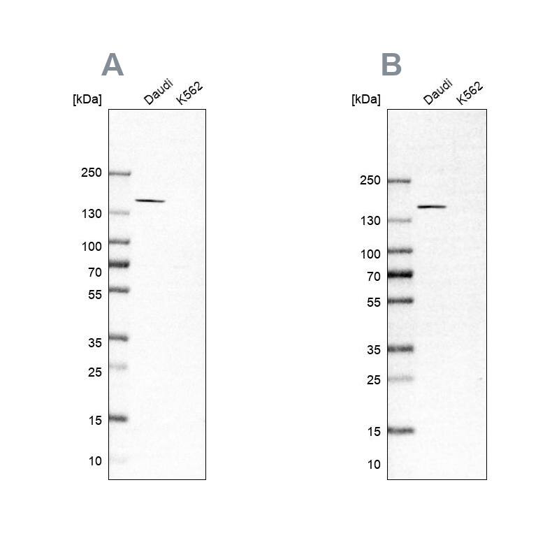 PLC-gamma 2 Antibody (NBP1-86030): Novus Biologicals