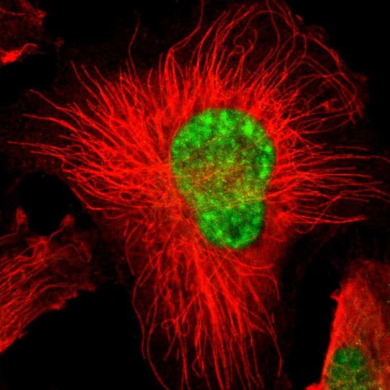 HCC1 Antibody (NBP1-88200): Novus Biologicals
