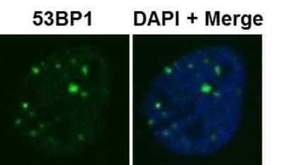 53BP1 Antibodies