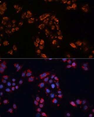 ABCB11 Antibody (NBP2-92689): Novus Biologicals