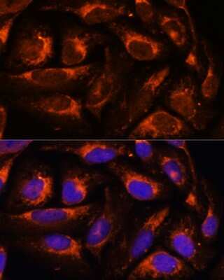 ACOX3 Antibody - Azide and BSA Free (NBP3-15513): Novus Biologicals