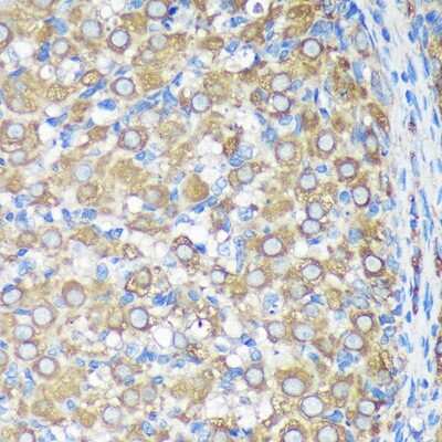 ALG5 Antibody (NBP2-92371): Novus Biologicals