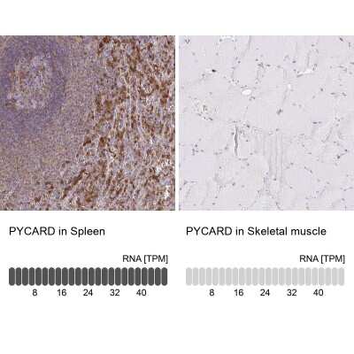 ASC/TMS1 Antibodies: Novus Biologicals