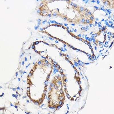 Adenine Nucleotide Translocase 1/2/3/4 Antibody (NBP3-05640): Novus ...