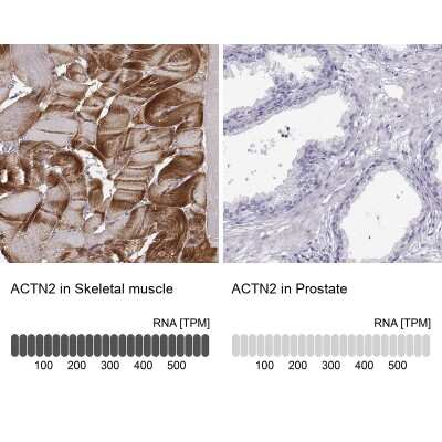 Alpha Actinin 2 Antibody (NBP1-90376): Novus Biologicals