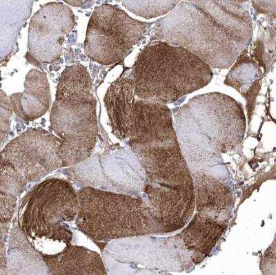 AlphaB Crystallin/CRYAB Antibody (NBP2-49246): Novus Biologicals