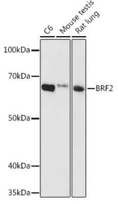 BRF2 Antibody (NBP2-92838): Novus Biologicals