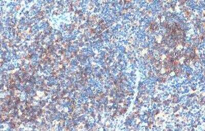 CD19 Antibody (NBP2-15782): Novus Biologicals