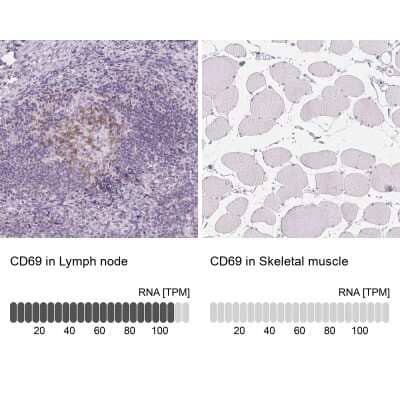 CD69 Antibodies: Novus Biologicals